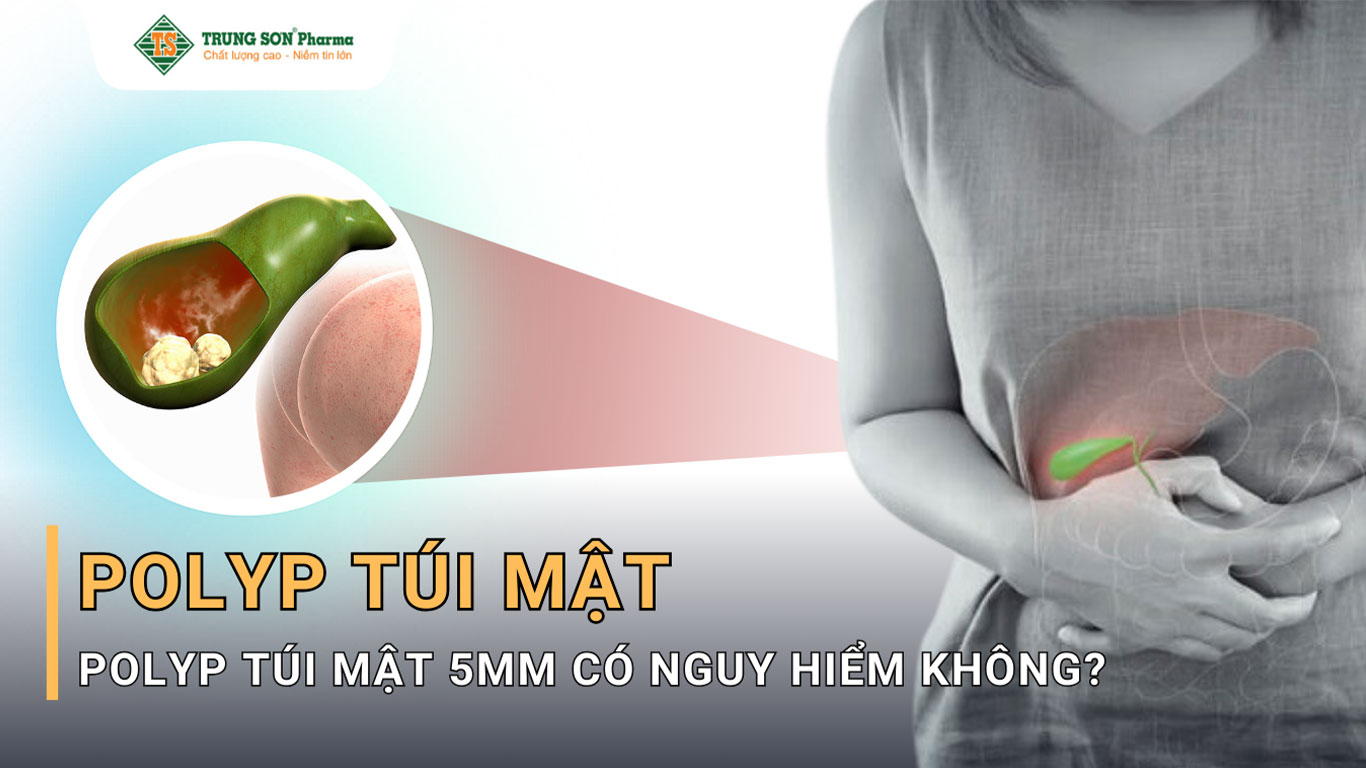 Polyp Túi Mật Là Gì? Polyp Túi Mật 5mm Có Nguy Hiểm Không?